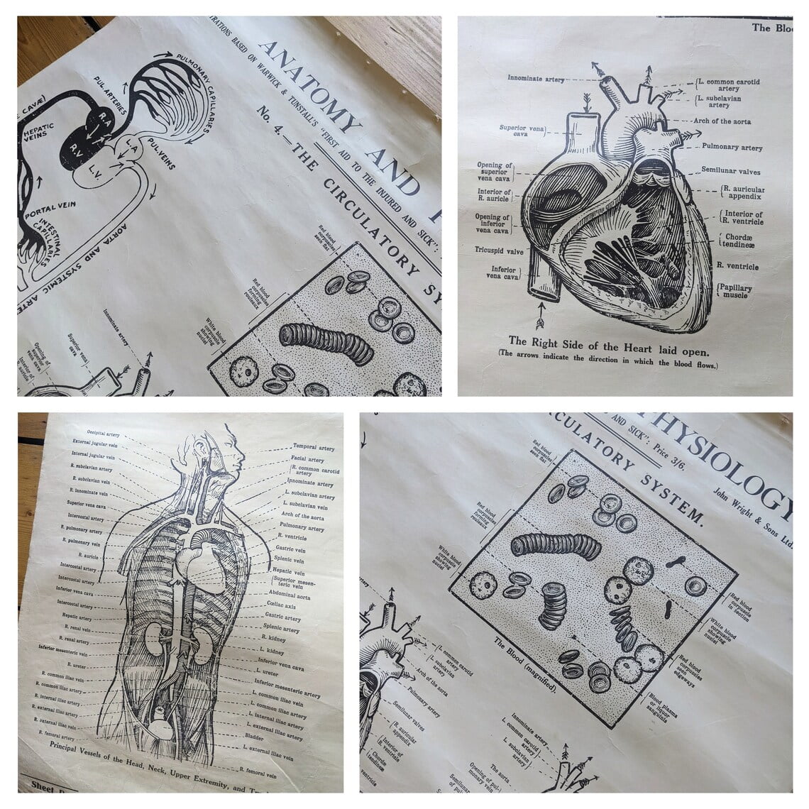 Early 20th C. large Medical diagrams, First Aid wall charts- available ...